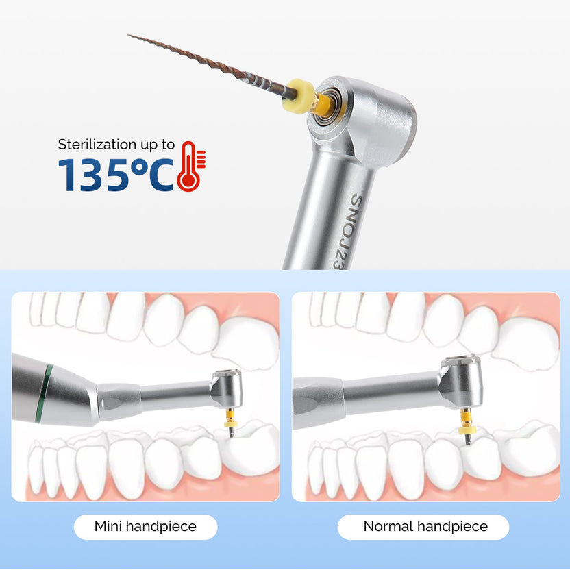 AZDENT Dental Wireless Endodontic Motor Root Canal Treatment With 16:1